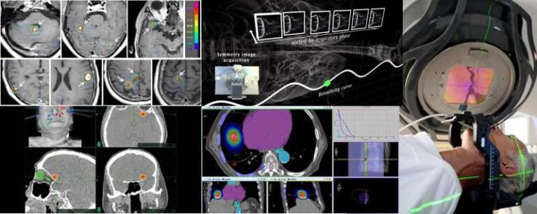 Top best radiosurgery hospitals - radiosurgery